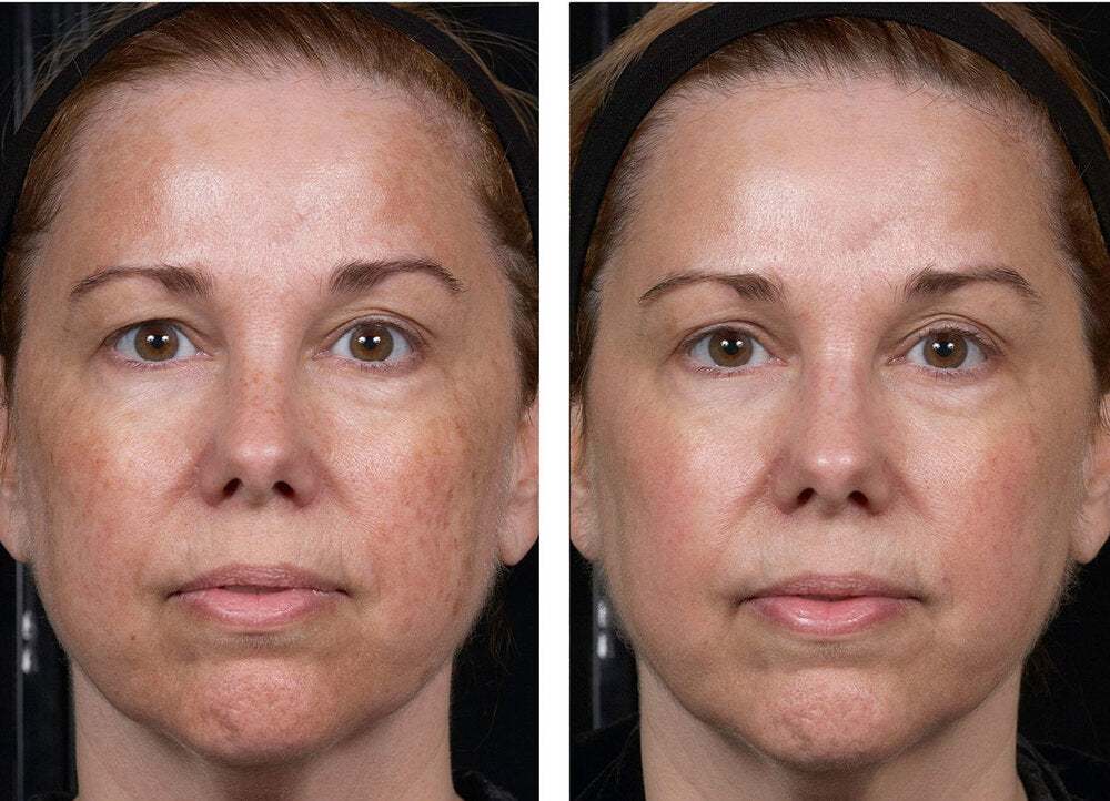 Blue Light Protection Skin Care with Timeless products – Timeless Skin ...